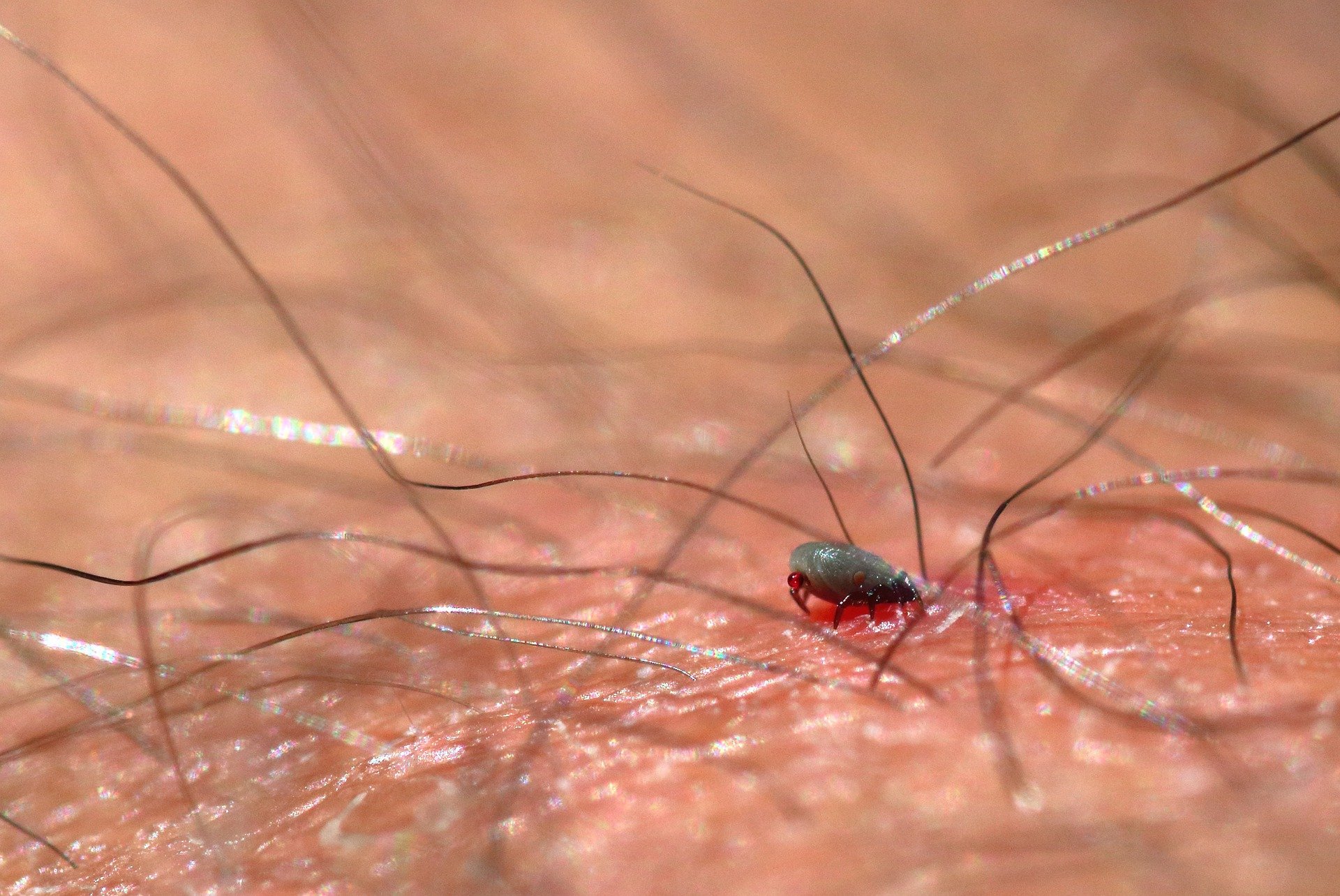 Protect from Ticks – Ticks & Lyme Disease